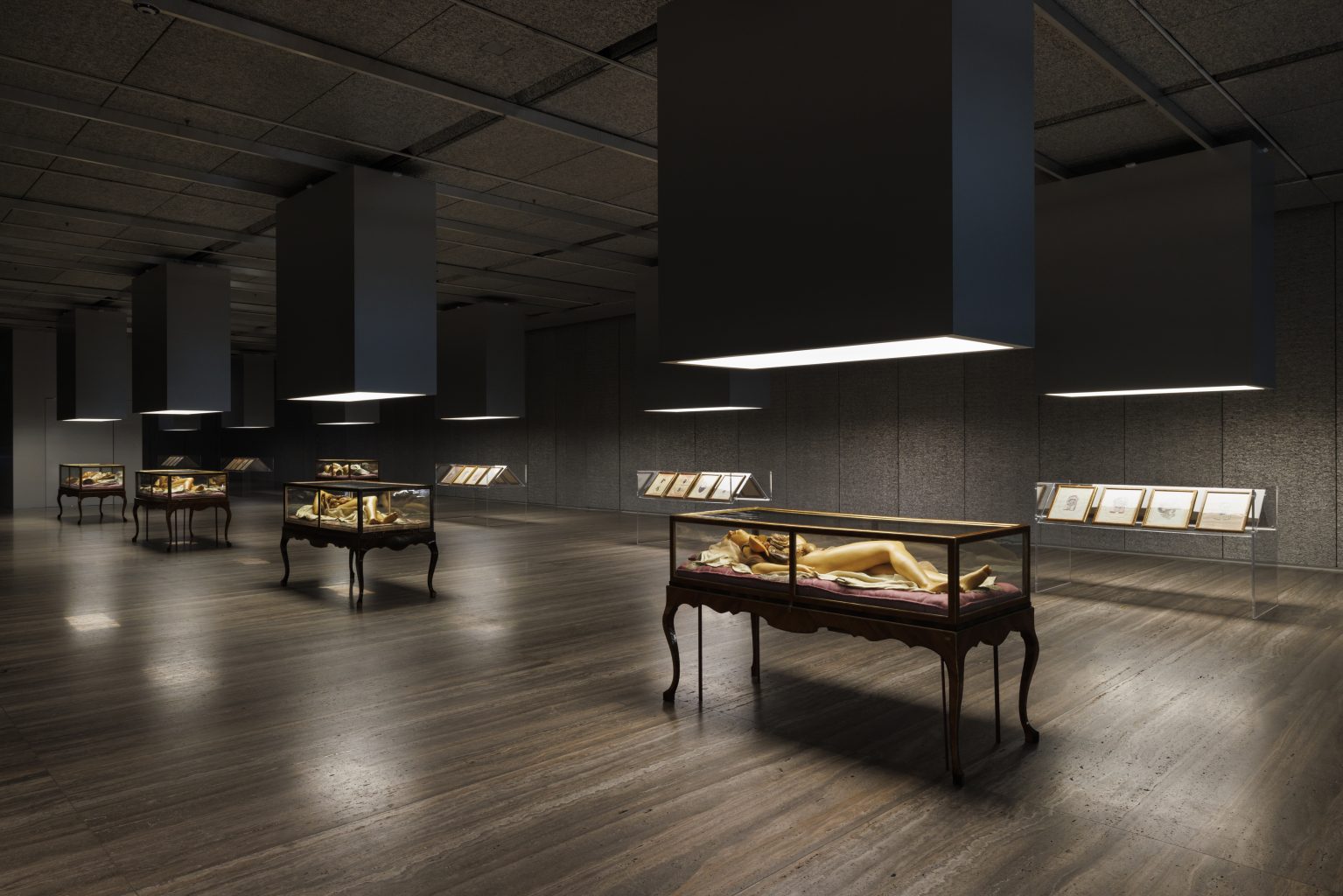 “Cere anatomiche”, in Fondazione Prada, varca la nostra tremenda realtà ...